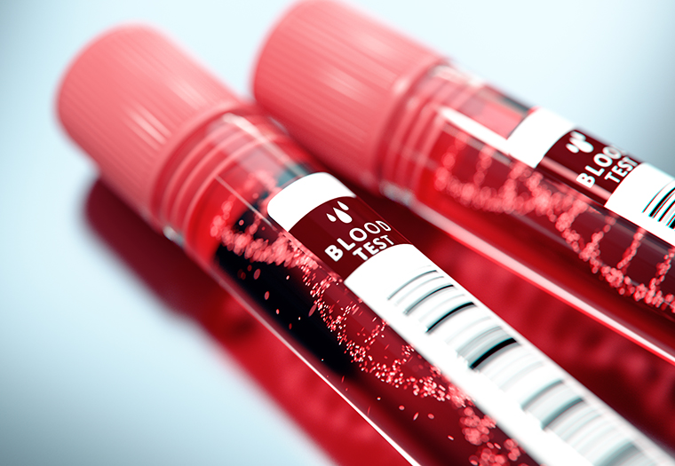 Prvi antigen test za otkrivanje koronavirusa zvanično odobren - Noob.ba